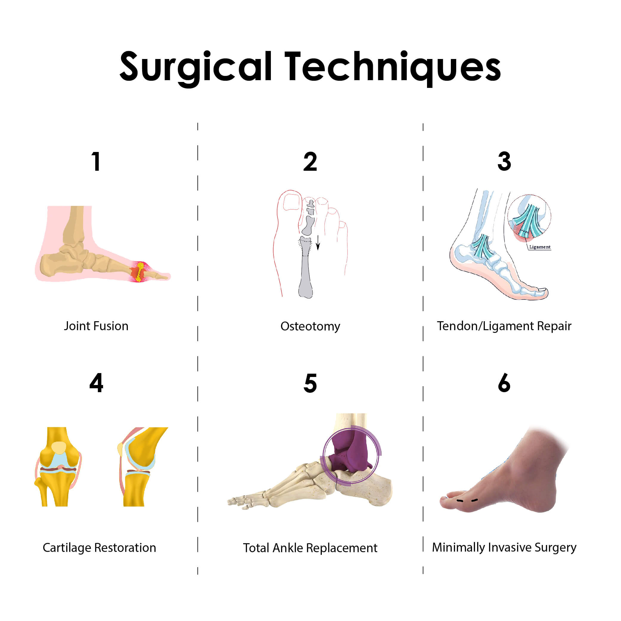 Reconstructive Foot & Ankle Surgery - Stat Podiatry